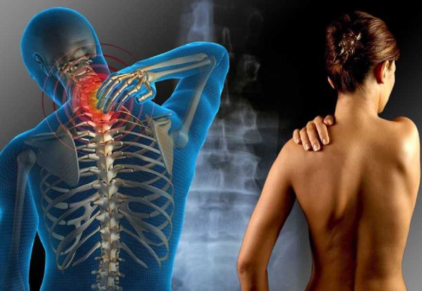 Rectificación cervical: conoce qué es y cómo tratarla CURADAS